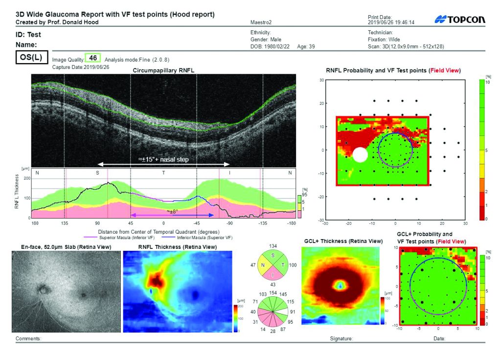 MECS (Minor Eye Conditions Service) - R. Woodfall Opticians of London
