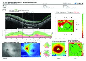 MECS (Minor Eye Conditions Service) - R. Woodfall Opticians of London