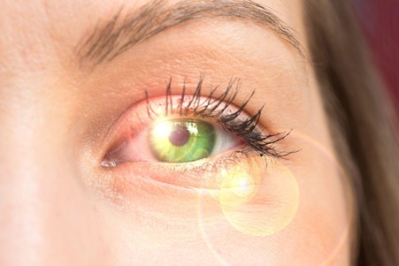 How The Sun Can Damage Your Eyes - R. Woodfall Opticians of London