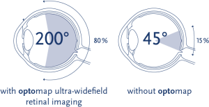 MECS (Minor Eye Conditions Service) - R. Woodfall Opticians of London