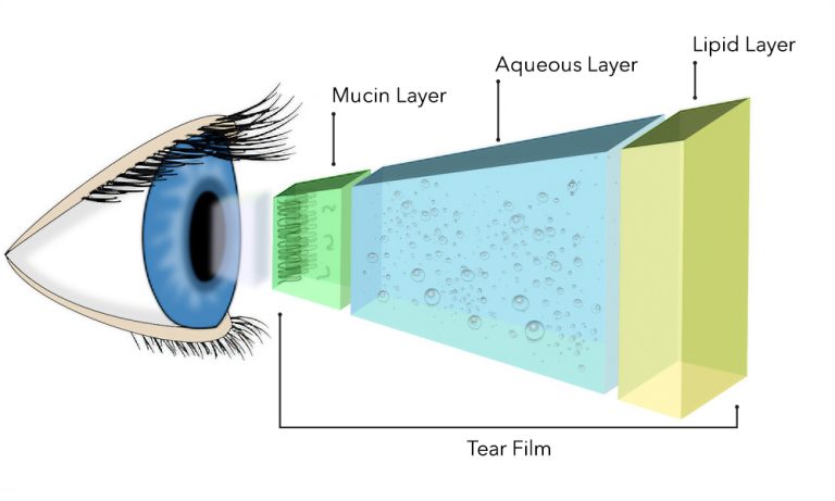 Dry Eye Management - R. Woodfall Opticians of London